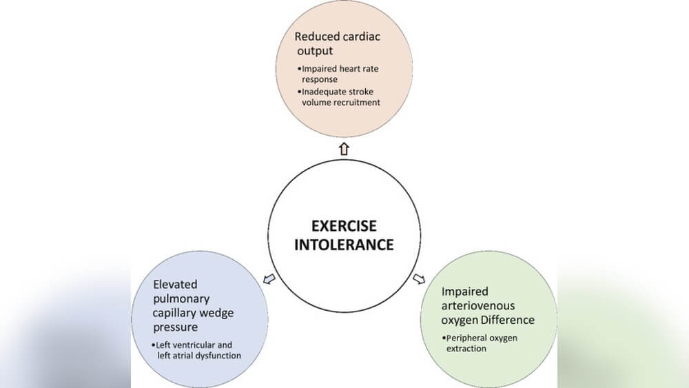 How to Exercise With Exercise Intolerance: Effective Tips for Success